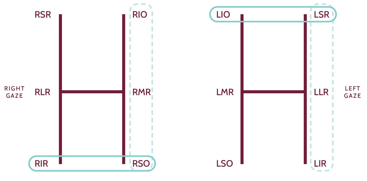 Isolating a Paretic Muscle Using the Parks 3-Step Test