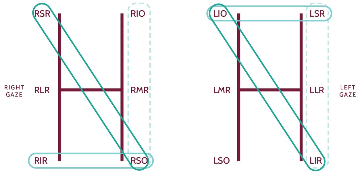Isolating a Paretic Muscle Using the Parks 3-Step Test